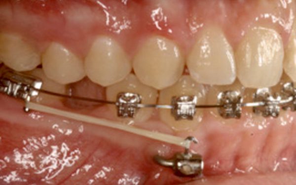 Orthodontiepraktijk Leeuwarden Botanker - Orthodontiepraktijk Leeuwarden