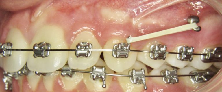 Orthodontiepraktijk Leeuwarden Botanker - Orthodontiepraktijk Leeuwarden